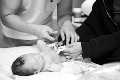 Delayed Cord Clamping - SCV Birth Center